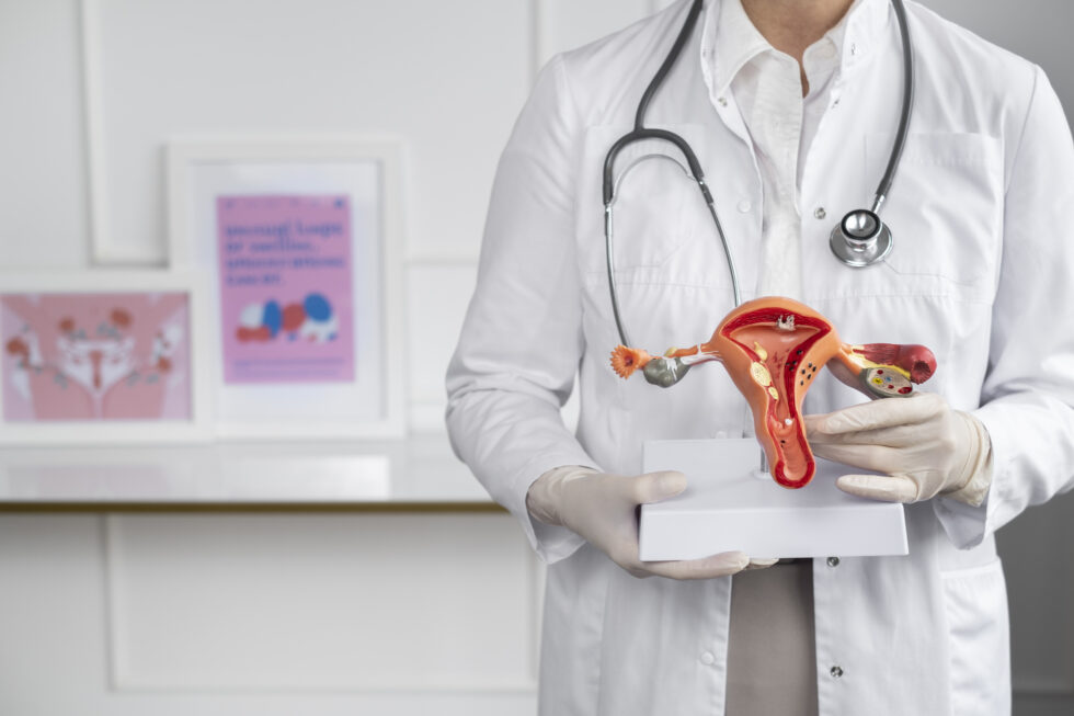 Síndrome de Ovario Poliquístico (SOP) | Todo en salud